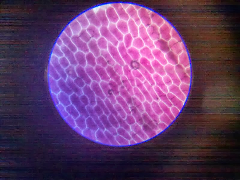 BIOLOGÍA-GEOLOGÍA//I.E.S. SIERRA BLANCA (MARBELLA): EPIDERMIS VEGETAL ...