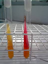 Kultur Murni: Tahukah Kalian Apa itu Isolasi Mikroba??