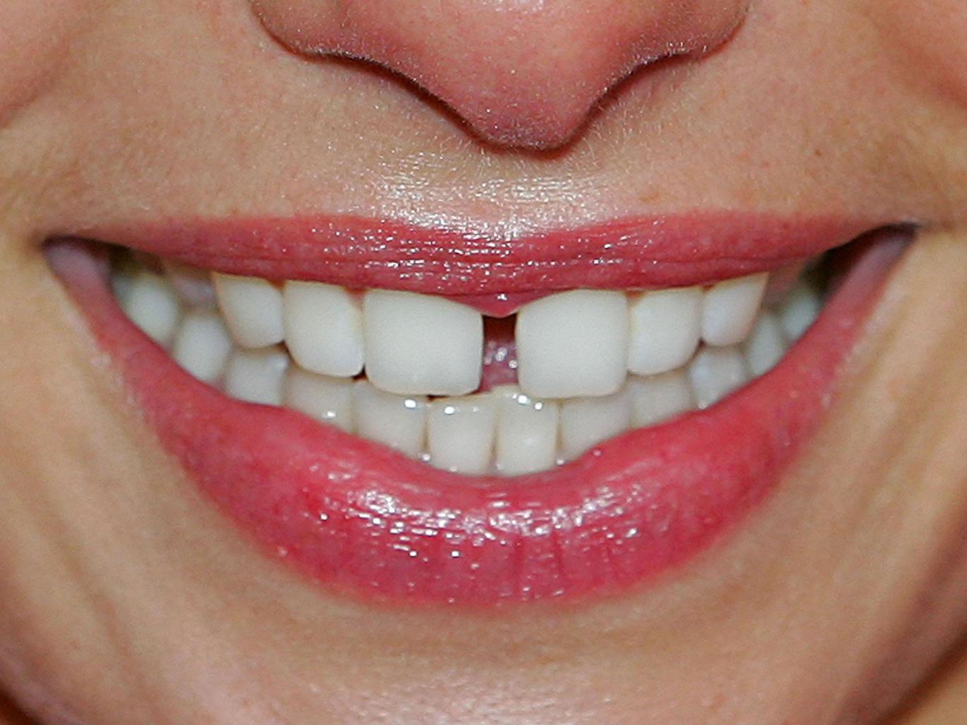 Germantown Dental Care Routine Dental Services Implants Root Canals germantown-dental-care-routine-dental-services-implants-root-canals