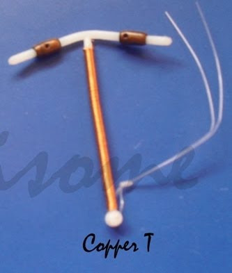 Bahaya IUD | Medianers