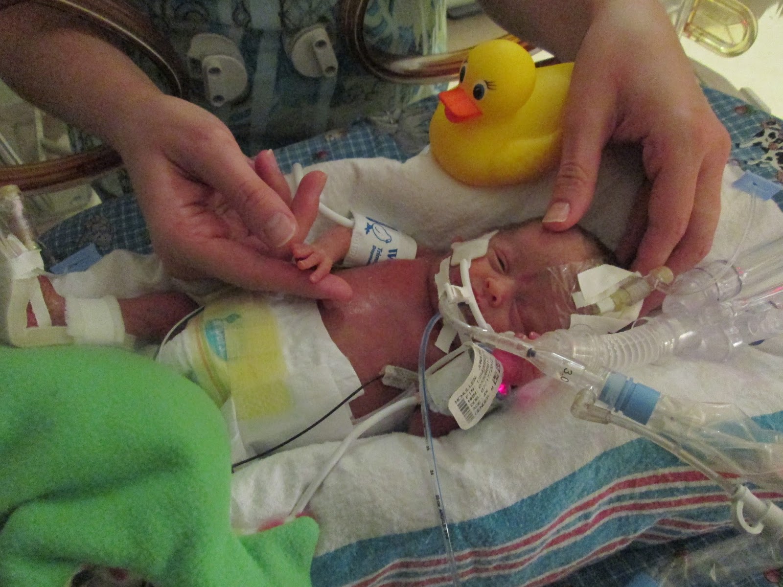 JAM sessions: Lessons learned through a micro-preemie: Day 40 & 41 ...