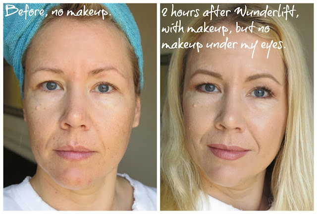 WUNDERLIFT 60 Second Wrinkle Reducer Review & BEFORE/AFTER PICTURES!