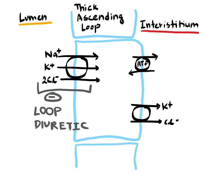Difference between Loop and Thiazide Diuretics in Calcium Metabolism