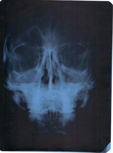 Chadwicks' Picture Place: X-Rays