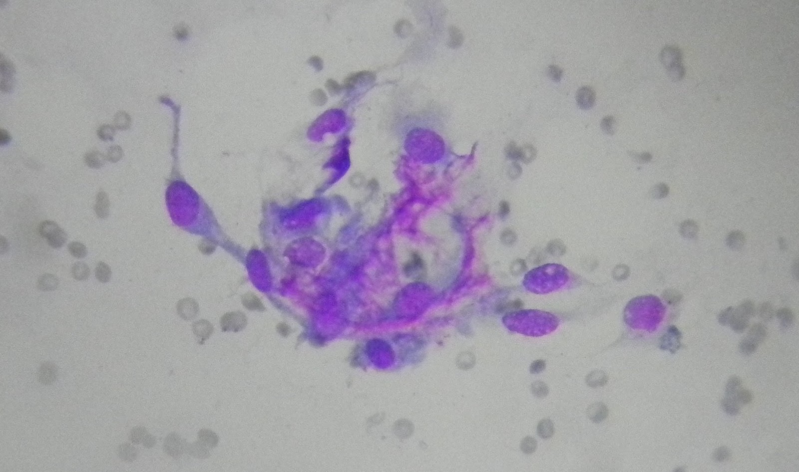 into the roots: Lung cytology