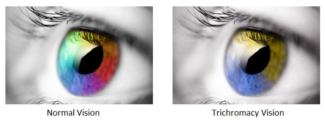 The Types of Colour Blindness - Healthy Eyes