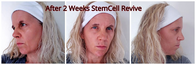 Here are the photos of my after 2 weeks