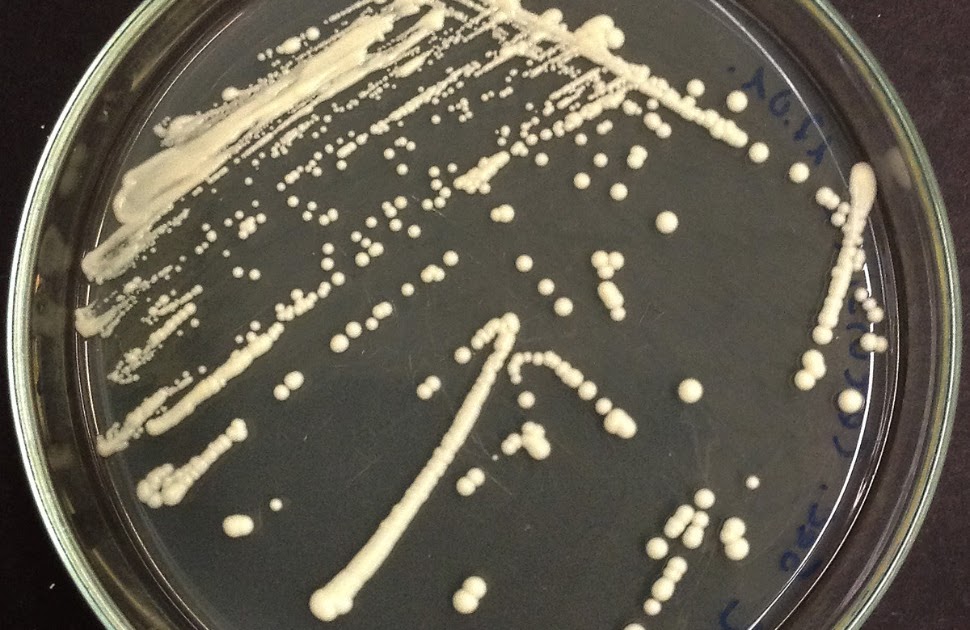 Biology Eleven: LAB: BACTERIA AROUND OUR SCHOOL