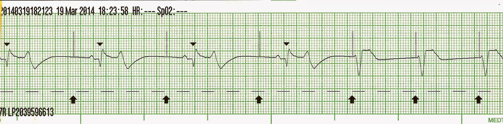 EKG Rhythm Quiz 270