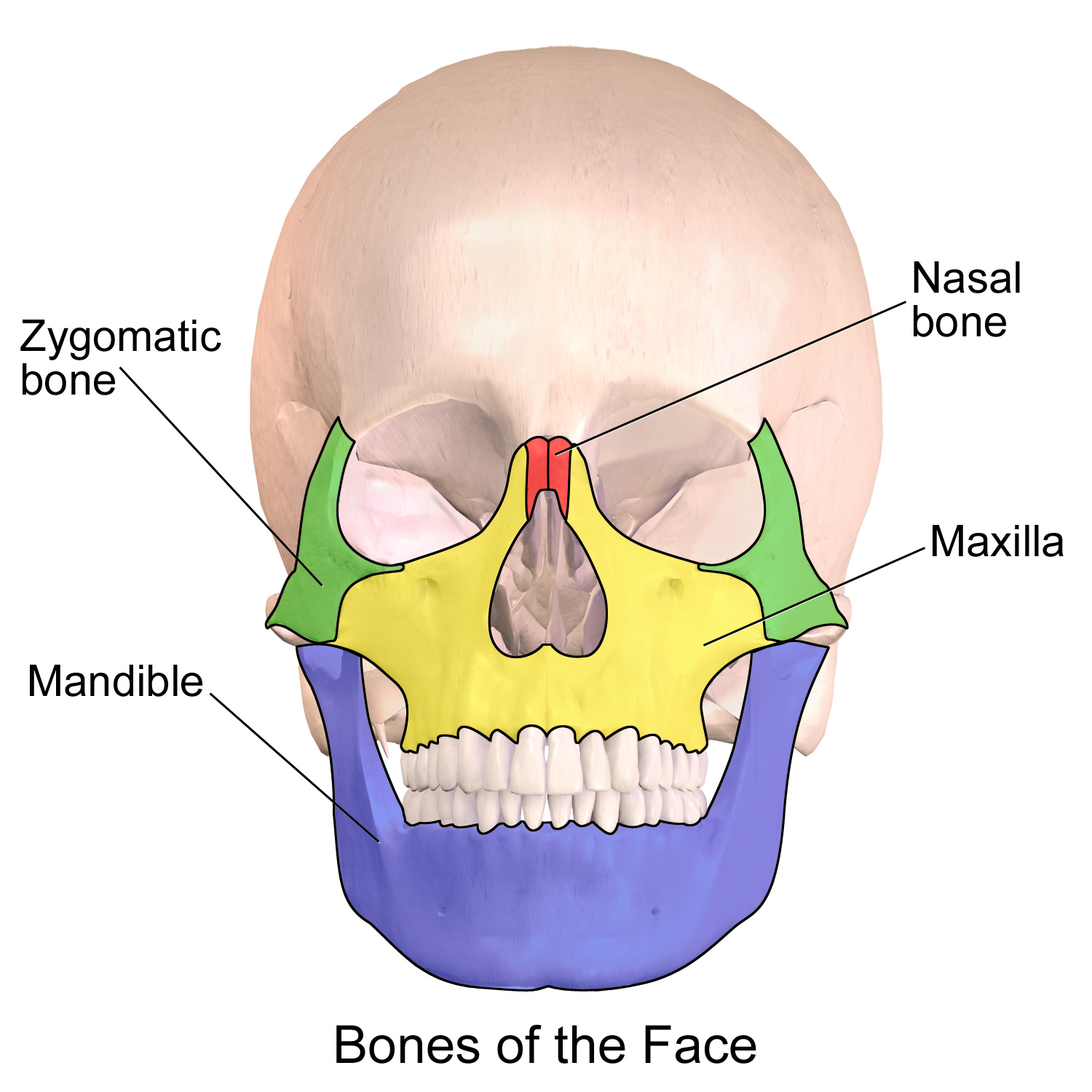 Maxillary Fracture Treatment | Maxillary Bone Fracture Surgery