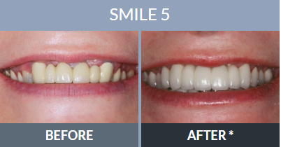 My Dentist in Plano: Smile Gallery