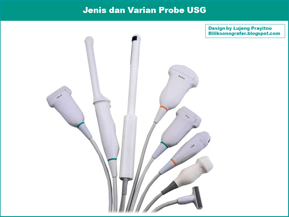 Sejarah Ultrasonografi (USG)