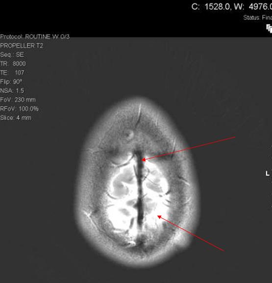 Michael's MRI Study Page: SECTIONAL ANATOMY