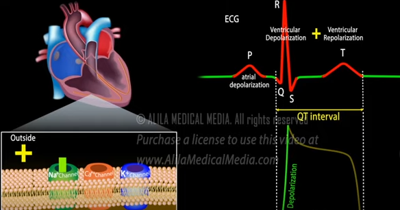 Long QT Syndrome and Torsades de Pointes