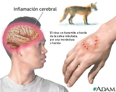 ENFERMEDADES MICROBIANAS: LA RABIA