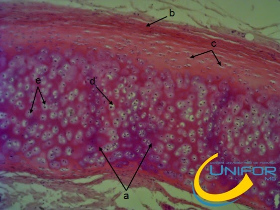 Atlas Histológico UNIFOR-MG: Cartilagem Hialina