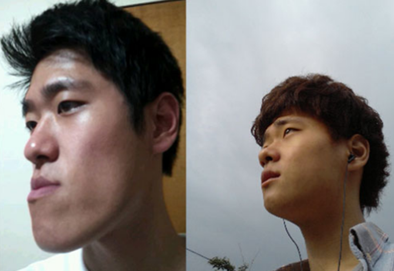 Real Review: Operasi 2 rahang