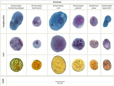 PARASITOLOGÍA: AMIBIASIS