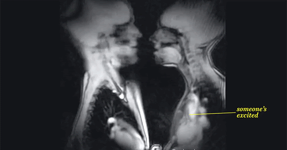 Josie's Juice: MRI sex: researchers capture MRI images - VIDEO