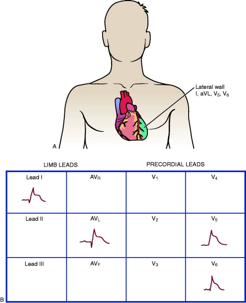 CCRN Review Questions & More