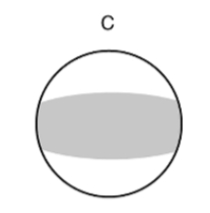 What are prism ballast, truncation, and dynamic stabilization in ...