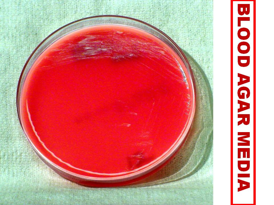 TYPES OF CULTURE MEDIA IN MICROBIOLOGY