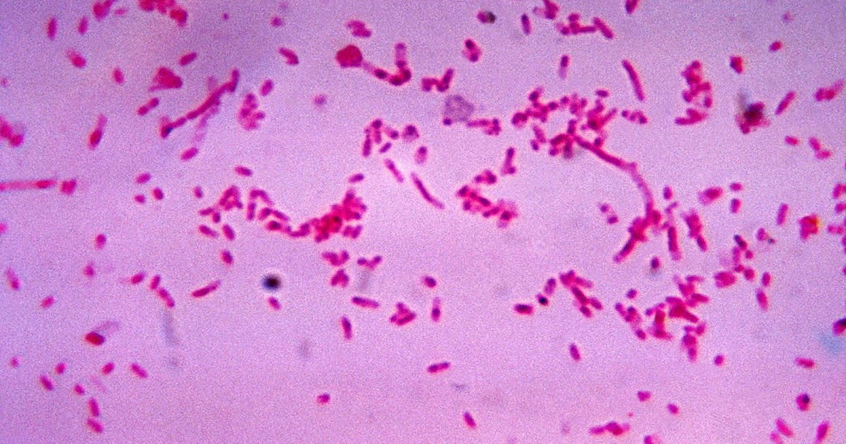 OVIPEDIA-UPFIM: Pododermatitis Interdigital O Gabarro (Amanecer ...