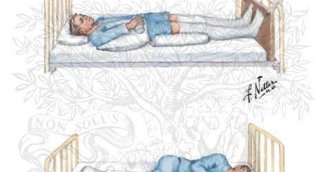 Importance of positioning for Stroke patients