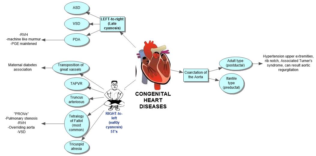 Medical MindMaps for USMLE Step 1: Congenital Cardiac Disease