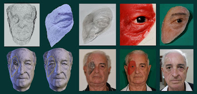 ATOR: Low cost human face prosthesis with the aid of 3D printing