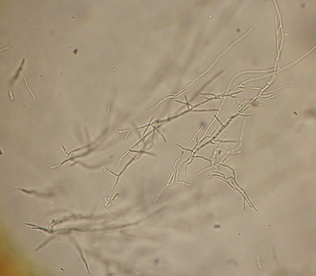 ATLAS MICOLOGIA: TRICHOPHYTON SOUDANENSE