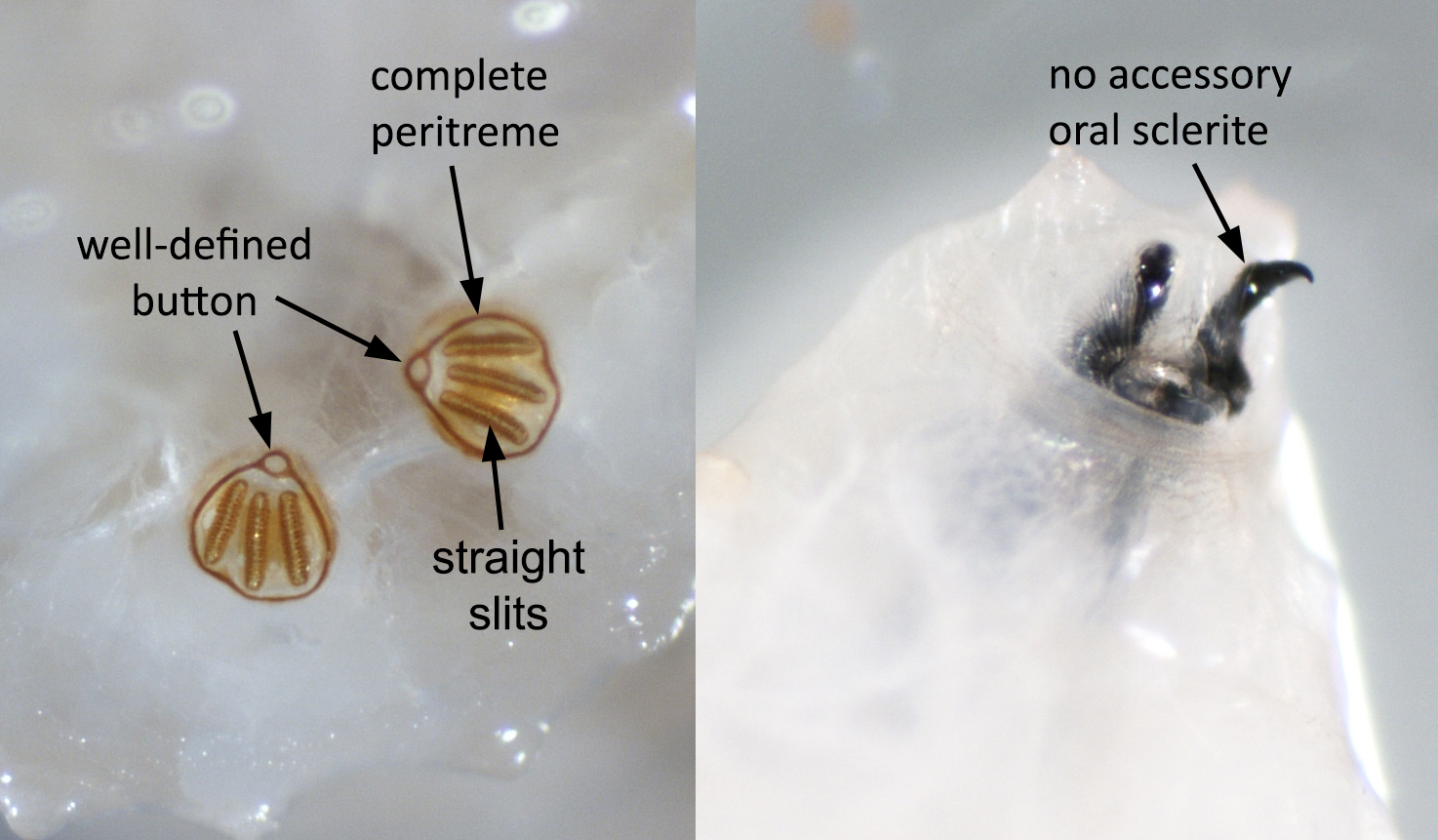 Creepy Dreadful Wonderful Parasites: Answer to Case 612