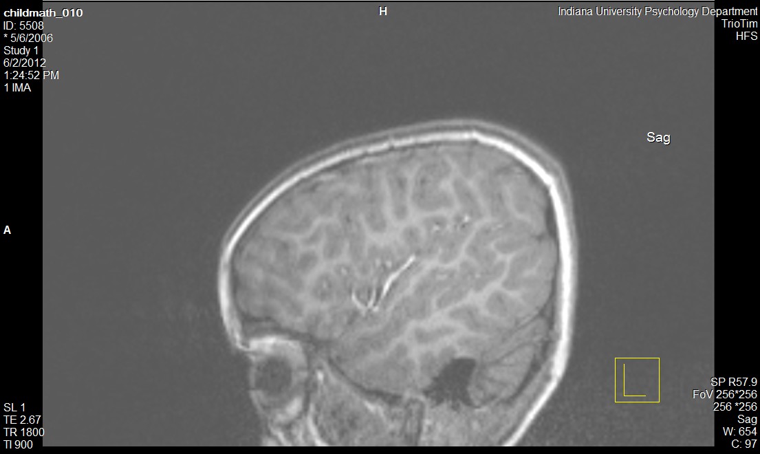 Craft Knife: I Let My Kid Get an MRI for Fun: The Child Scientist ...