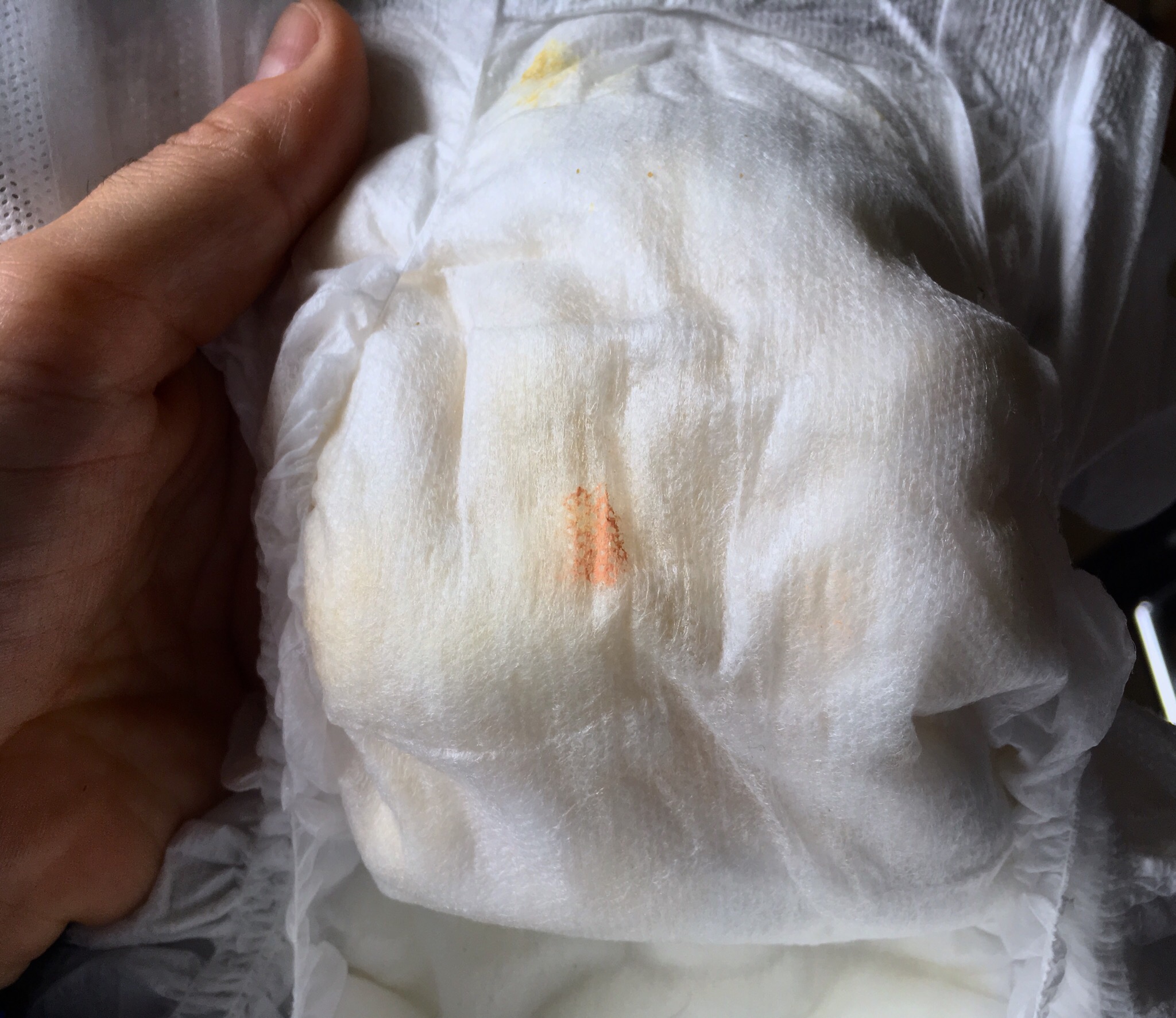 Mi bebé recien nacido orina color naranja. ¿a que se debe doctor?