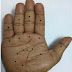 Meaning Of Moles & Spots On Hand In Western Palmistry ~ INDIAN PALM ...
