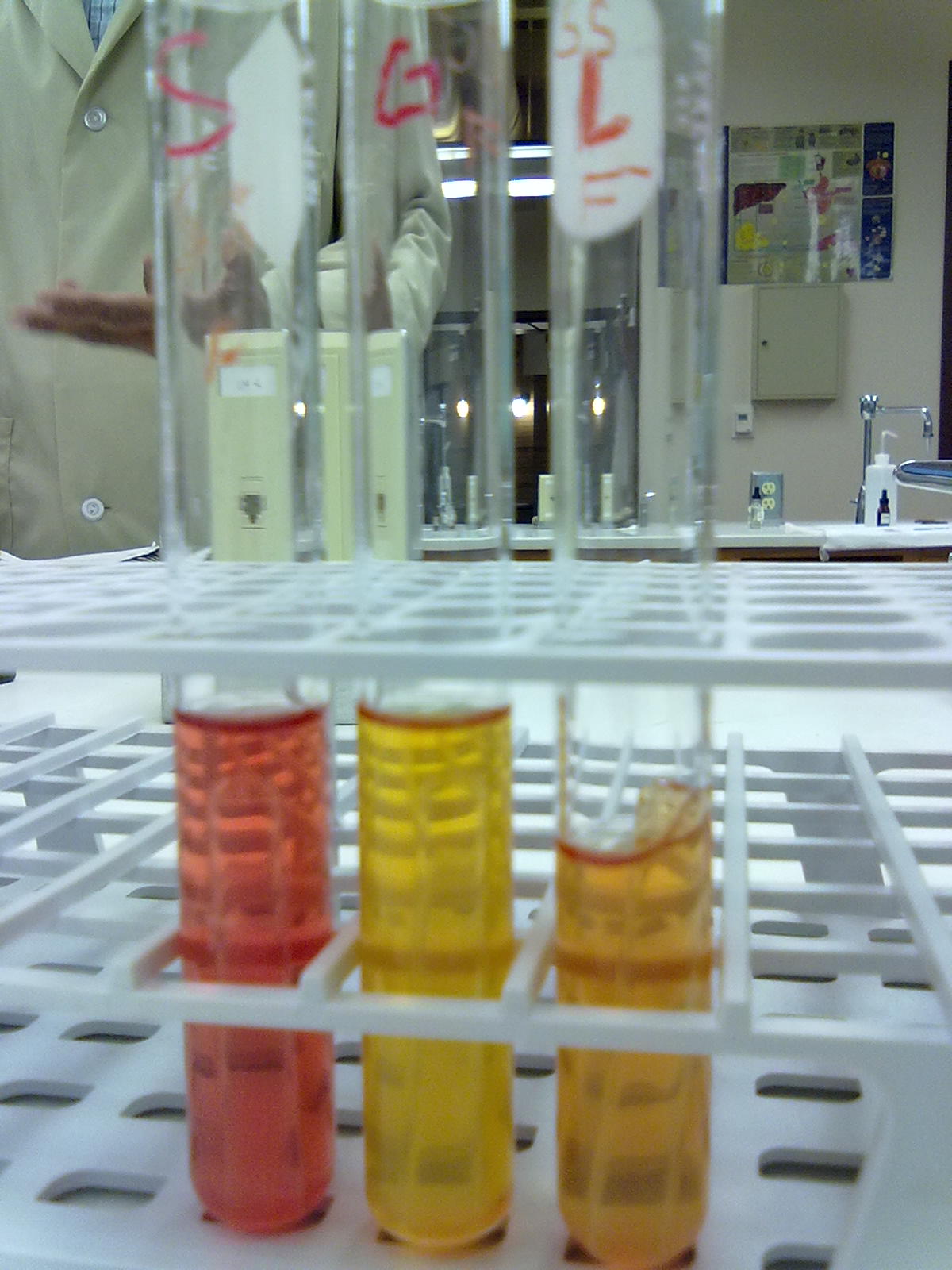 Samantha and Sarah's Microbiology Lab Journal: The Results! Gelatin and ...