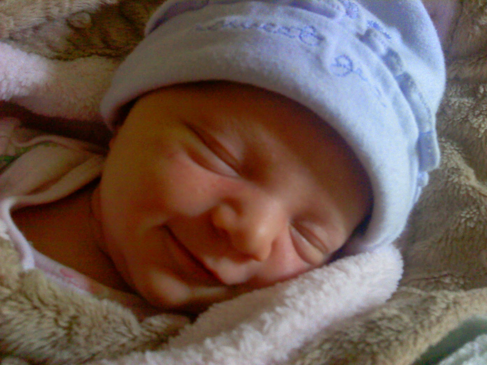 PUPPPs Relief: My PUPPPs Story: Baby #2