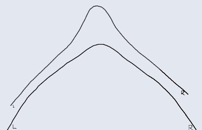Saddle Fitting: The Inside Journey: Interpreting the Template Revisited