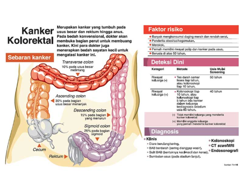 Kanker Kolorektal, Gejala, Penyebab dan Pencegahan Terlengkap - karya ...