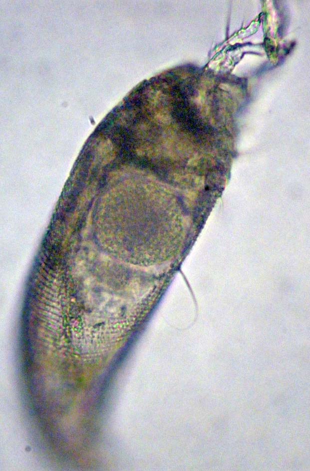 Air Bubble Microscope