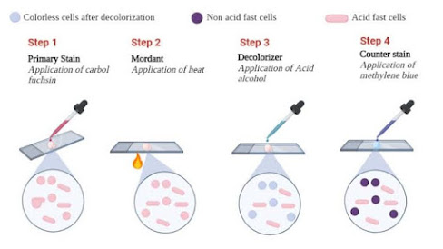 Acid-Fast Staining : Principle, Procedure, Interpretation and Examples.