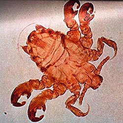 Tipos // Piojos púbicos, o "Ladilla" ~ Enfermedades Venereas