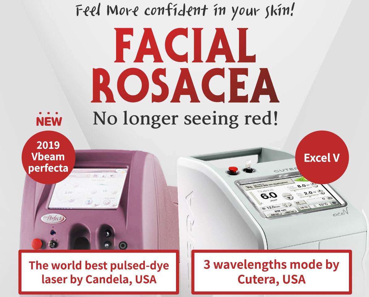 Renewme Skin Clinic: New 2019 V beam perfecta laser & Excel v laser ...