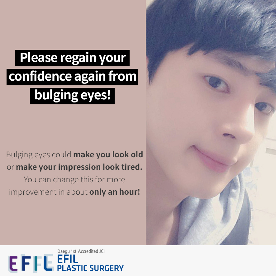EFIL Bulging Eyes Plastic Surgery JCI: Exophthalmos surgery, protruded ...