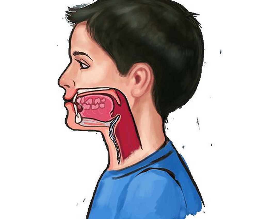 Deglución Atípica - Importancia en las maloclusiones - OdontoVida