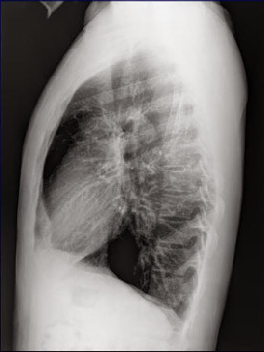 WiseMed: Radiografia de Tórax - parte II