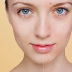 Cara Membuat Kulit Mulus dan Sehat