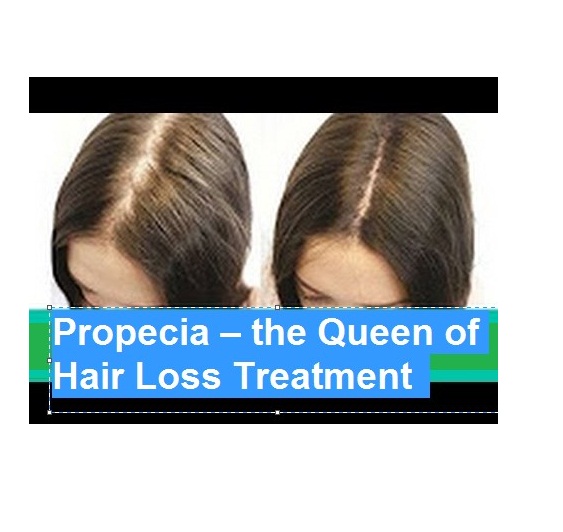 Propecia – the Queen of Hair Loss Treatment