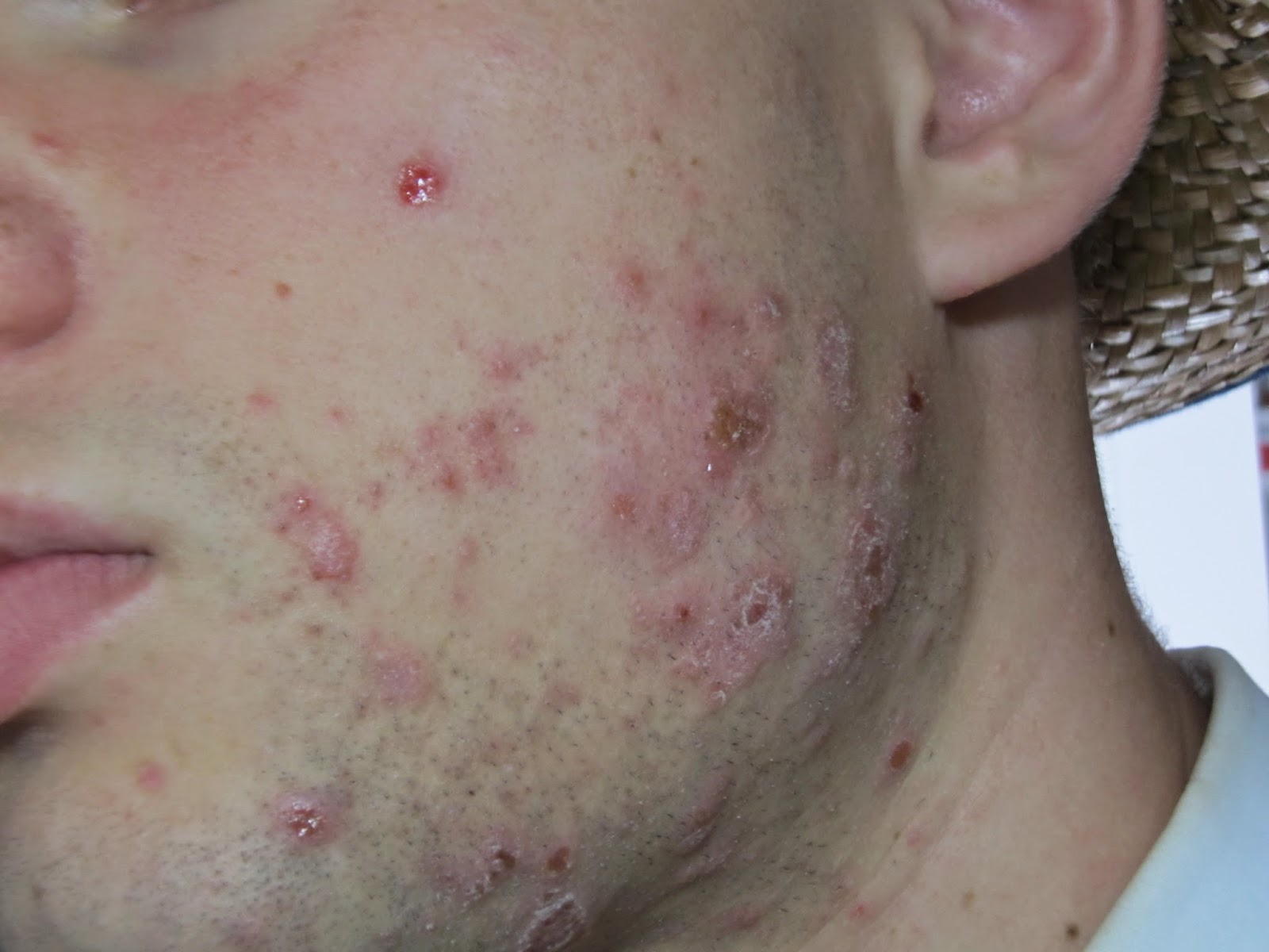 Argentine Adventures with Elder Pickle