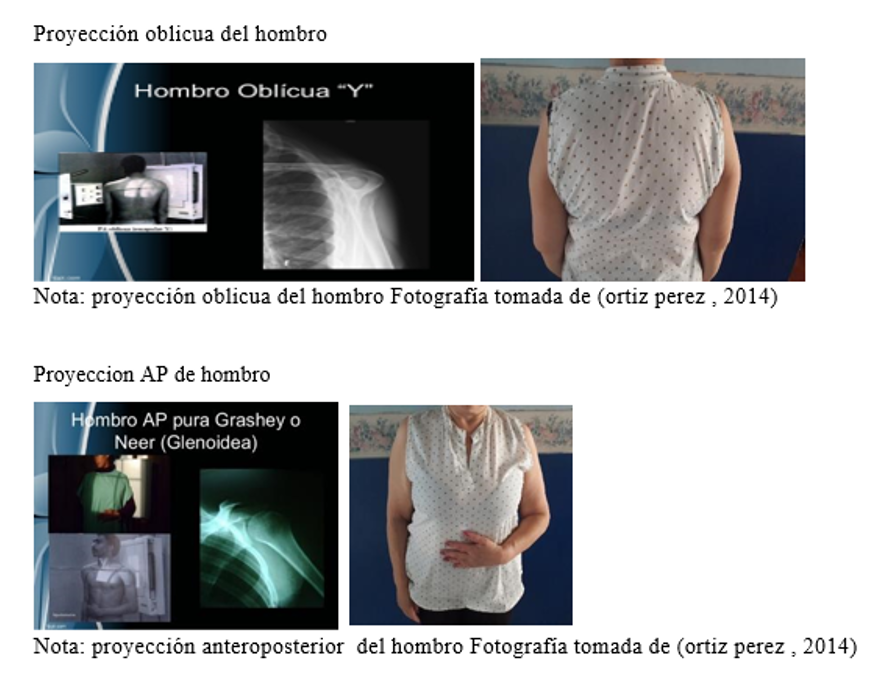 CONCEPTUALIZACION ANATOMICA : ESTUDIOS RADIOGRAFICOS DE MIEMBROS SUPERIORES